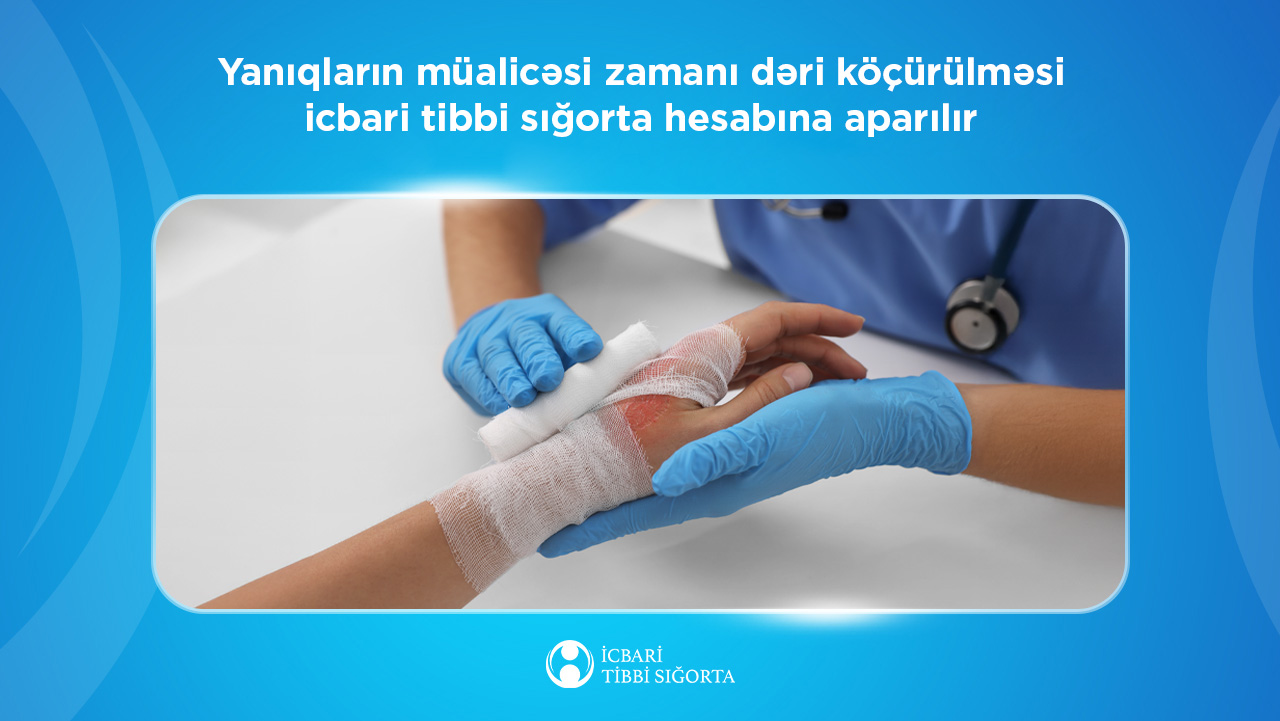 Yanıqların müalicəsi zamanı dəri köçürülməsi icbari tibbi sığorta ...